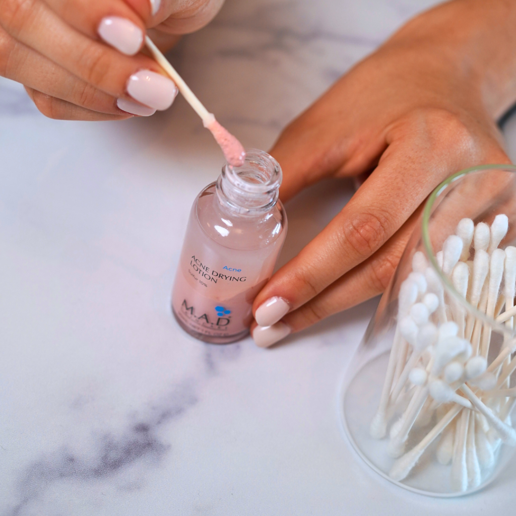 SAY GOODBYE TO ACNE ONCE AND FOR ALL WITH M.A.D SKINCARE’S EXPERT ...